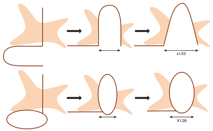 Essential Aspects of Transposition Flaps, Particularly Z-Plasties | SpringerLink