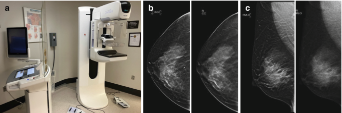 Breast Imaging | SpringerLink