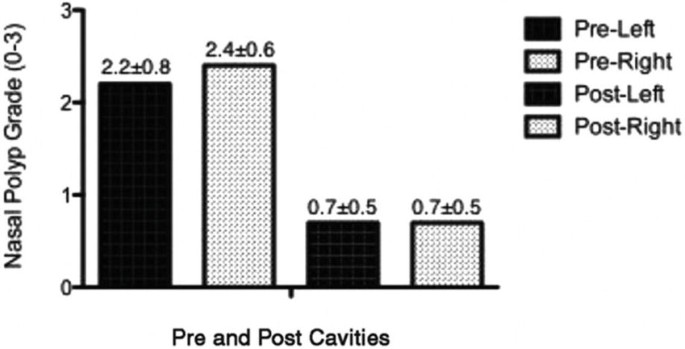 In Office Polypectomy for Recalcitrant Chronic Sinusitis with Polyposis ...
