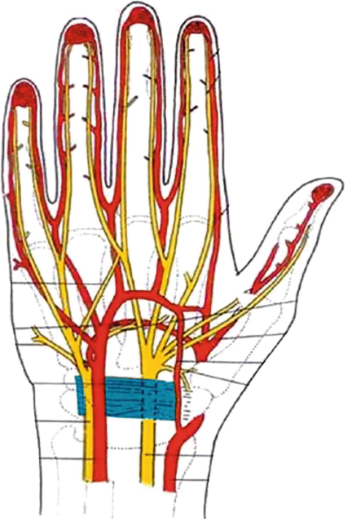 Finger Replantation | SpringerLink