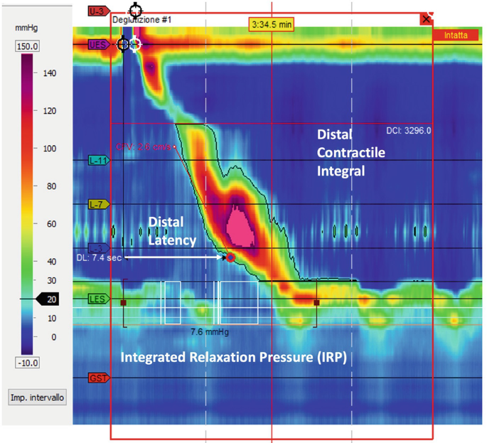 Functional Motor Disorders of the Esophagus | SpringerLink