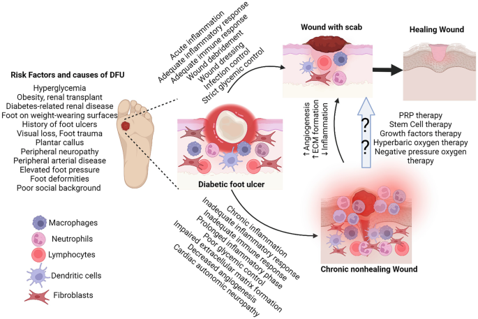 Diabetic Foot Ulcer and Cardiac Autonomic Neuropathy | SpringerLink