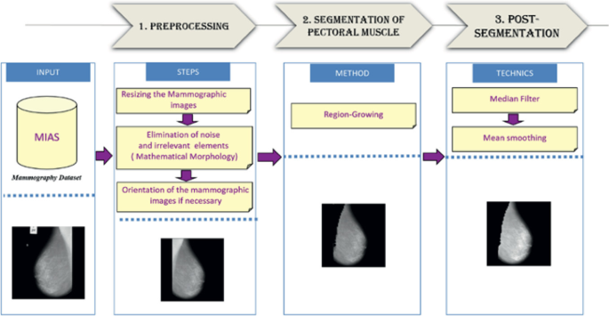 Toward an Enhanced Approach for Pectoral Muscle Segmentation in MLO ...