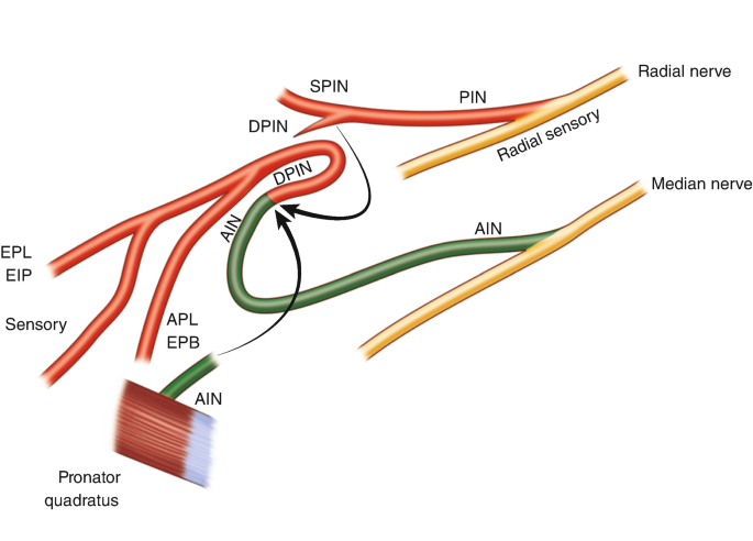 Anterior Interosseous Nerve (AIN) Branch of the Pronator Quadratus to ...