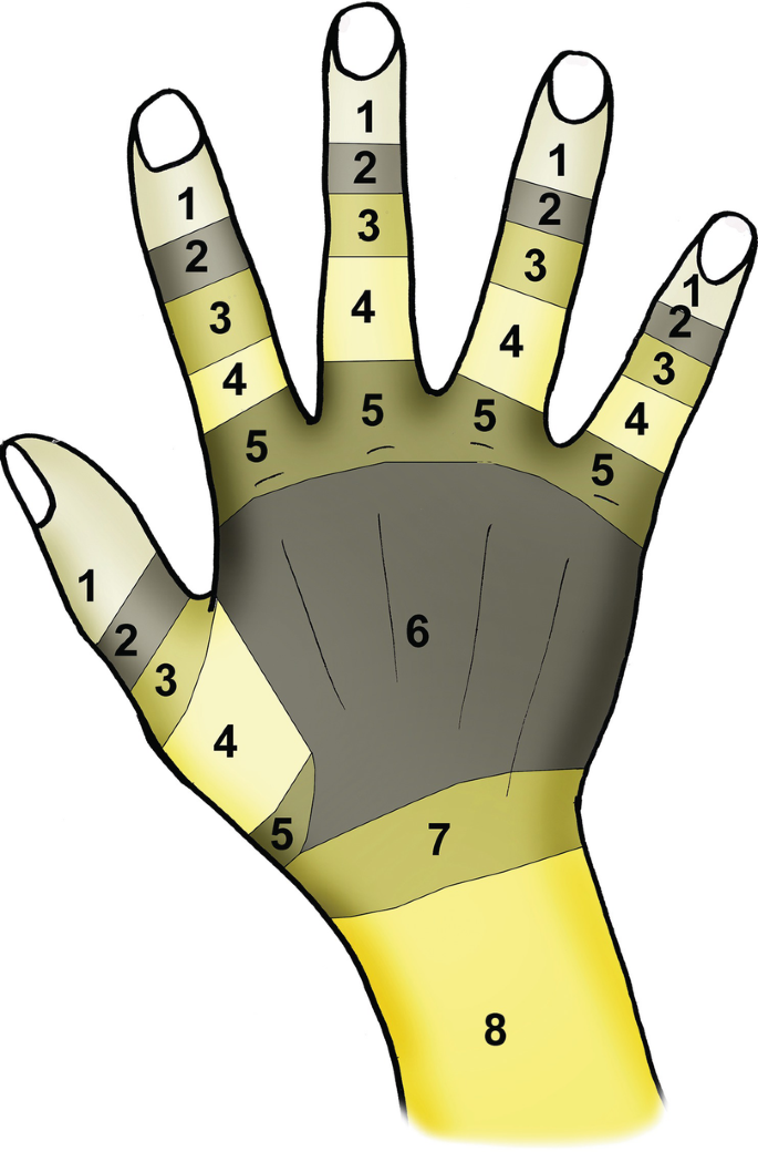 Injuries of the Extensor Tendons | SpringerLink