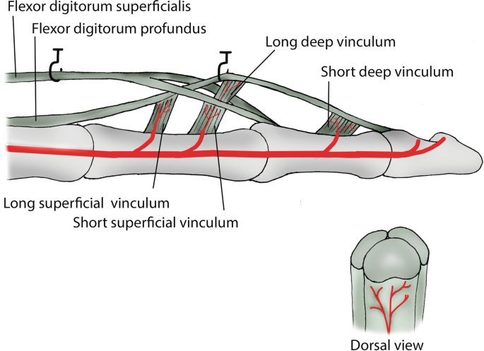 Injuries of the Flexor Tendons | SpringerLink