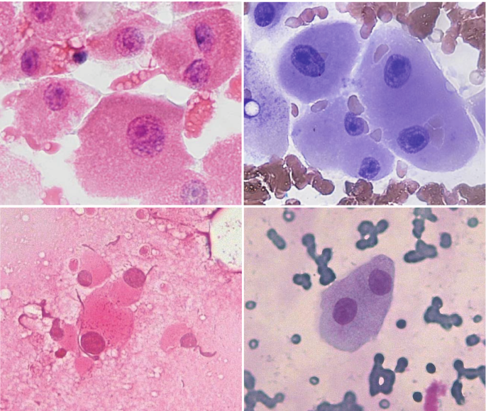 Oncocytic Cells: Nature and Significance | Springer Nature Link
