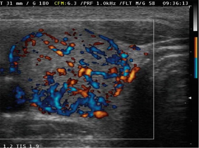 Thyroid Ultrasound Examination and Reporting | SpringerLink