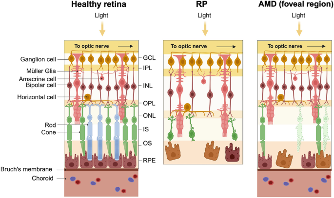 Retinal Organoid Development: Disease Modeling and Therapeutic ...