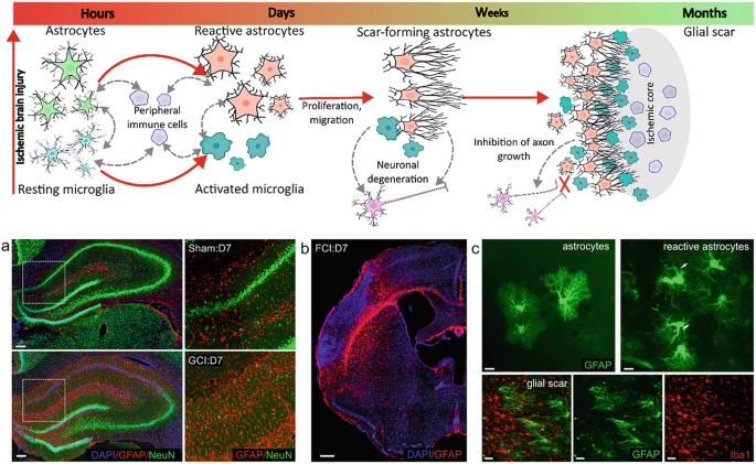 Correction to: Glial Engineering and Glial Interfaces | Springer Nature ...