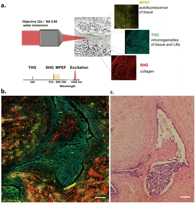 Nonlinear Optical Microscopy for Cancer Diagnosis | Springer Nature Link