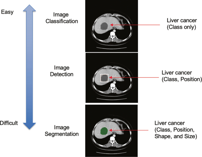 Deep CNNs for Image Classification, Object Detection, and Segmentation ...
