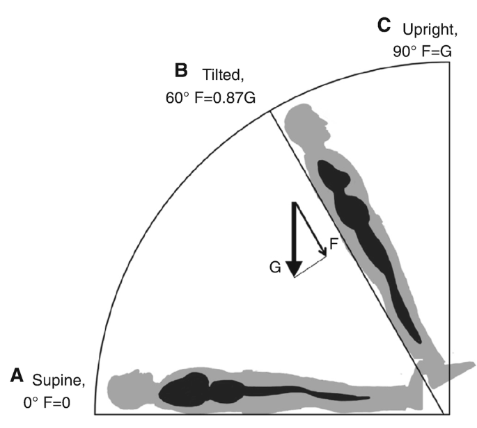 Tilt Table Testing | Springer Nature Link