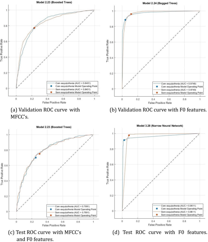 AI Schizophrenia Diagnosis Through Speech Features F0 and MFCC ...