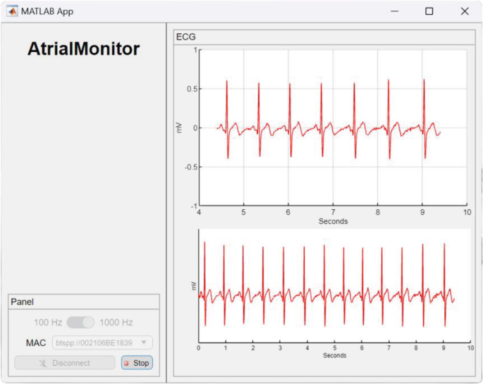 Graphical User Interface to Acquire ECG Using MATLAB and BITalino ...
