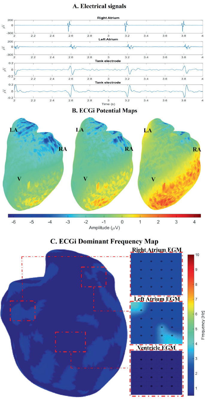 Electrocardiographic Imaging Performance From Rabbit Hearts Signals ...