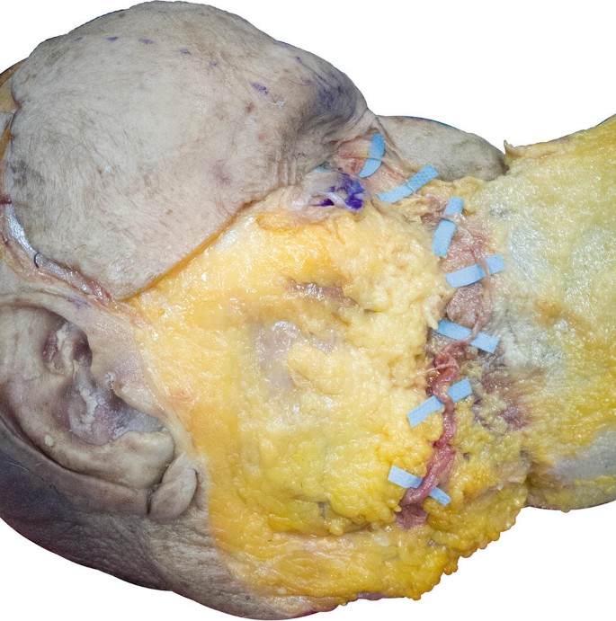 Surgical Anatomy of the Face and Neck | SpringerLink
