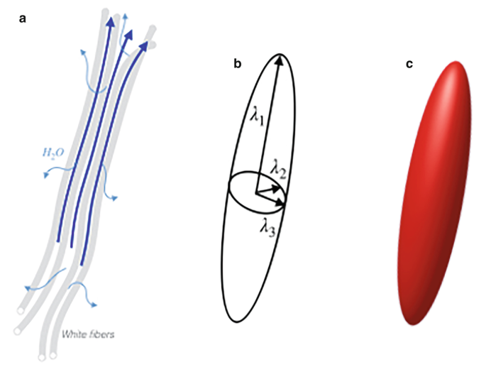 Place of Diffusion Imaging in Neurosurgical Anatomy | Springer Nature Link