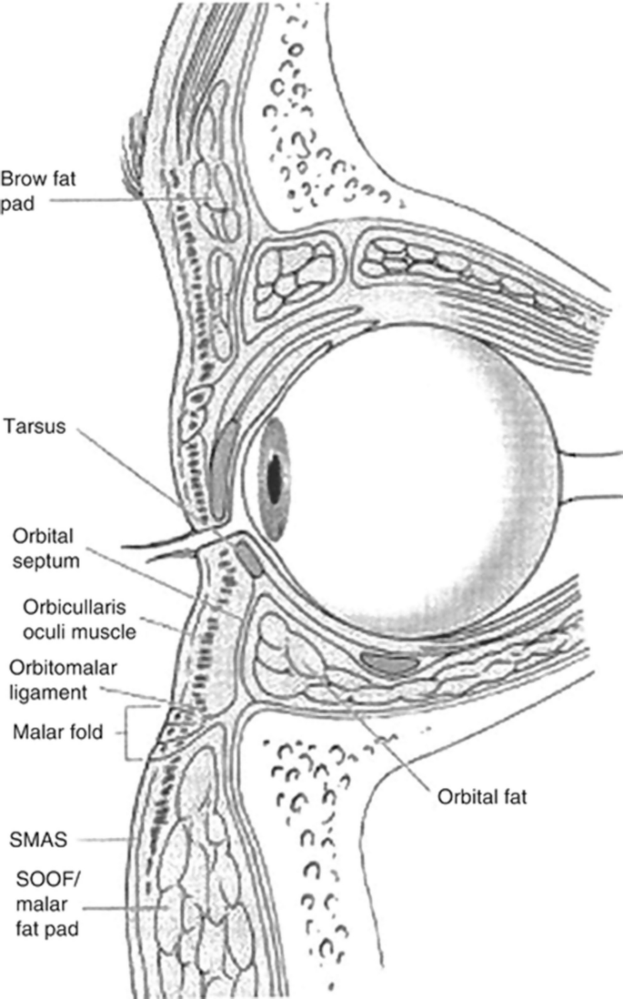 Ptosis | Springer Nature Link (formerly SpringerLink)