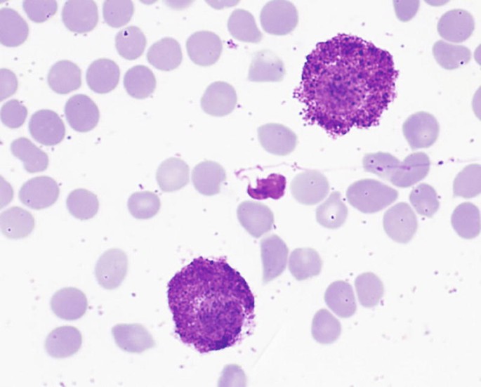 The Inflammatory Cells of the Skin and Related Cytological Patterns ...
