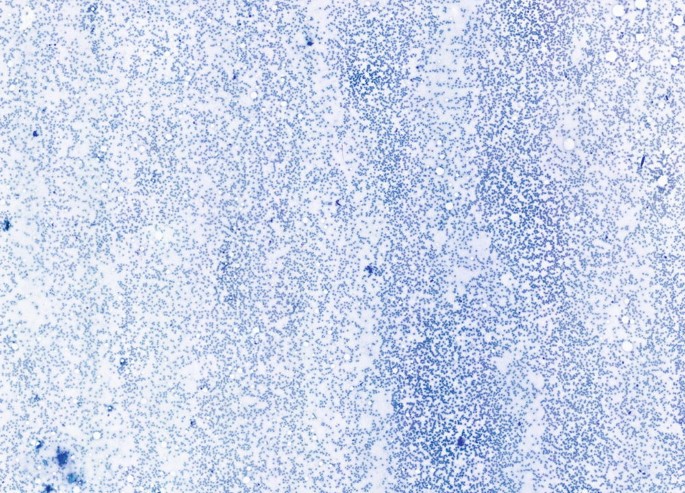 The “Background” in Skin Cytology | Springer Nature Link