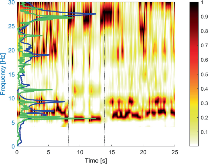 Time-Frequency Analysis of Railway Bridges Forced and Free Vibrations ...