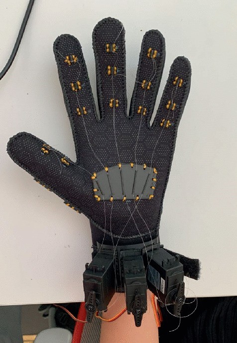 Orthosis Control Based on Electromyographic Signals and Machine ...