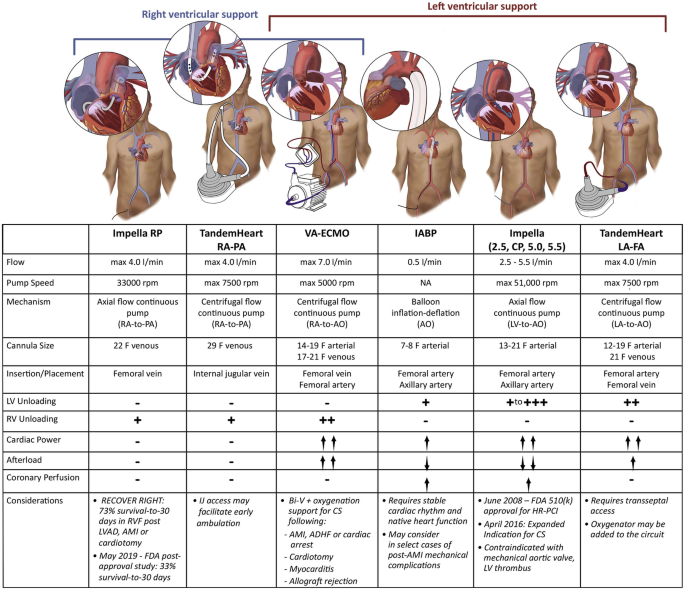 Mechanical Circulatory Support | SpringerLink