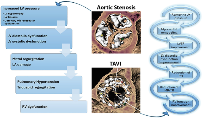 20 Years of TAVI—How Can We Get to a Comprehensive Patient Management ...
