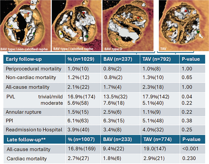 20 Years of TAVI—How Can We Get to a Comprehensive Patient Management ...