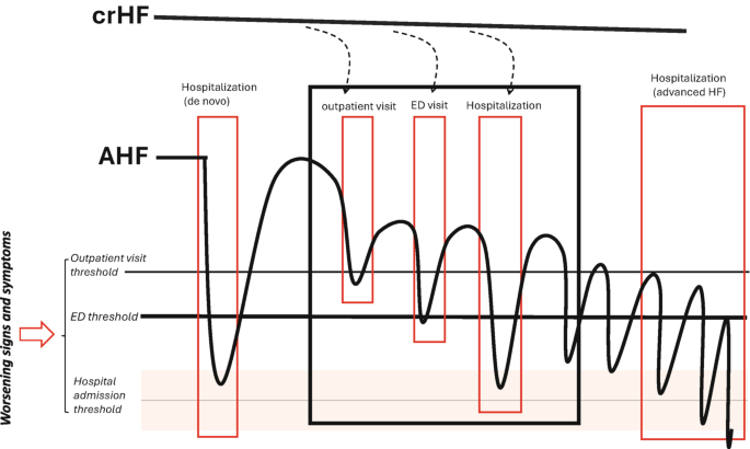 Acute Heart Failure: Epidemiology, Treatment, and Outcomes | SpringerLink