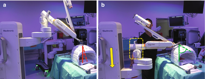 The Medtronic Hugo Robotic-Assisted Surgery (RAS) System | SpringerLink