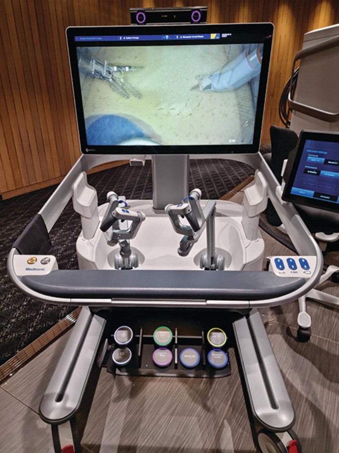The Medtronic Hugo Robotic-Assisted Surgery (RAS) System | SpringerLink