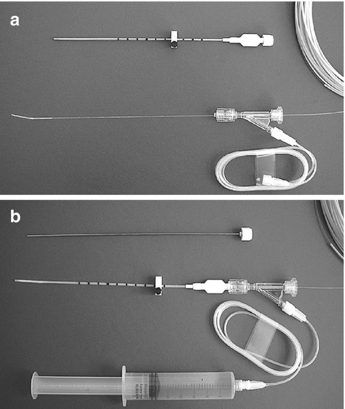 Laser Ablation: Lung | Springer Nature Link