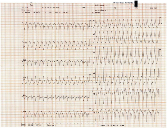 ECG 9 | Springer Nature Link