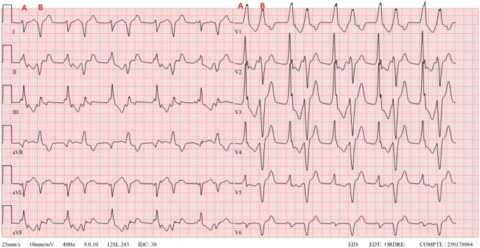 ECG 15 | SpringerLink