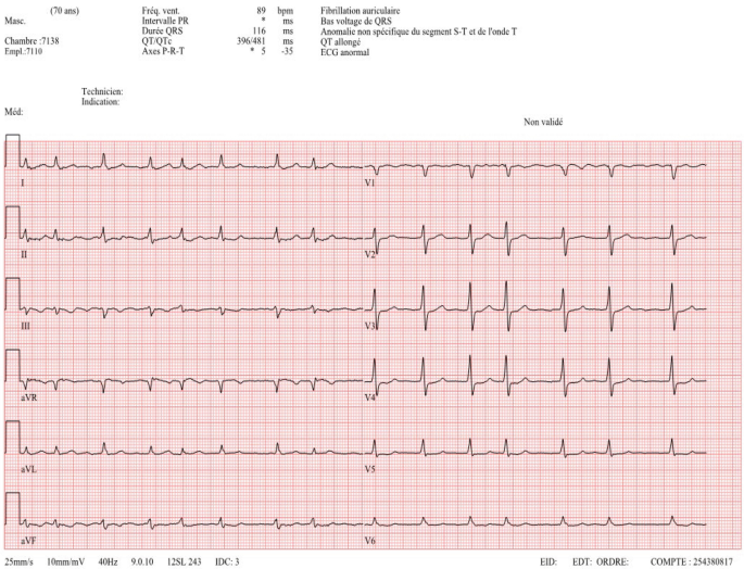 ECG 16 | SpringerLink
