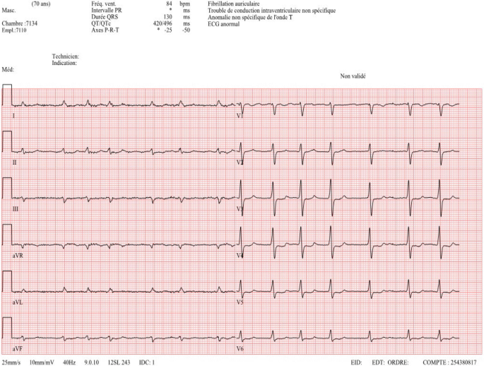 ECG 16 | SpringerLink