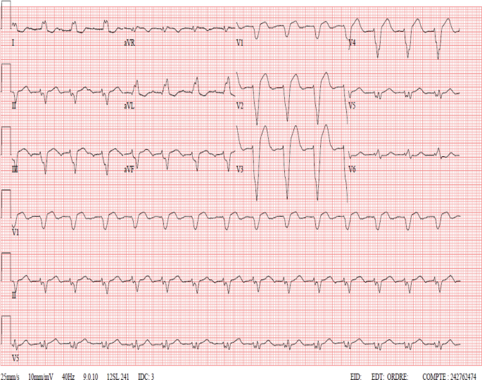 ECG 17 | SpringerLink