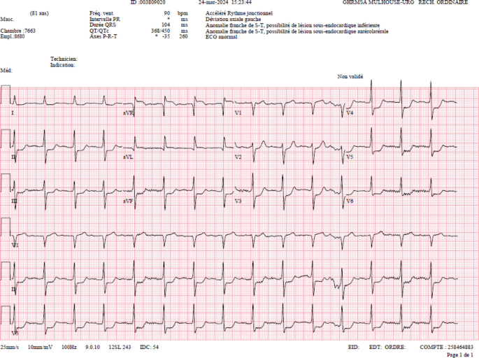 ECG 1 | SpringerLink