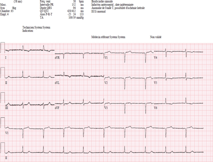ECG 19 | Springer Nature Link