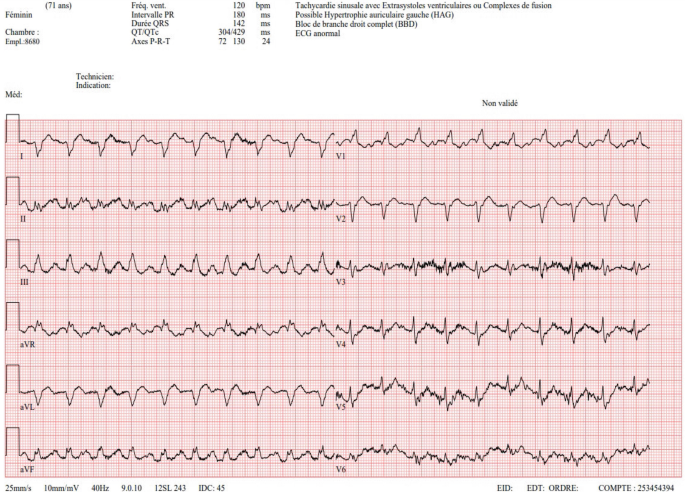 ECG 25 | SpringerLink