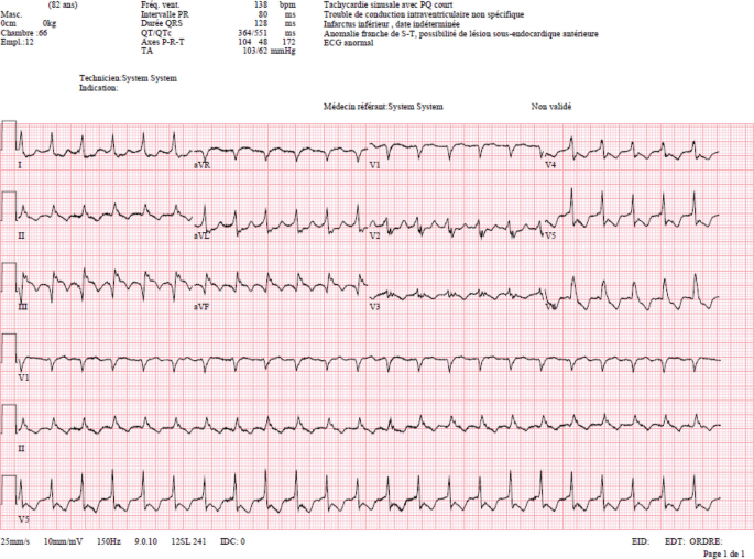 ECG 28 | Springer Nature Link