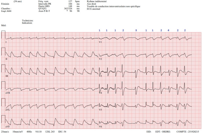 ECG 33 | Springer Nature Link