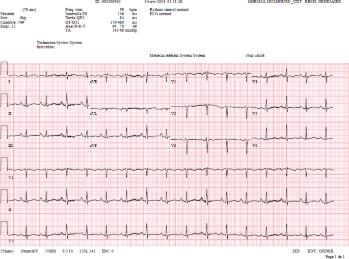 ECG 42 | SpringerLink