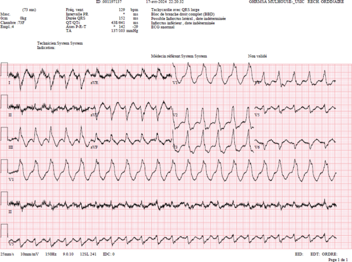 ECG 47 | Springer Nature Link