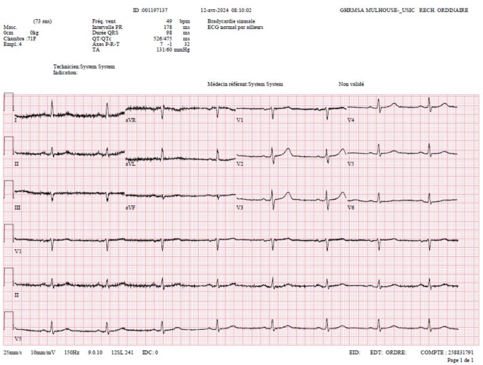 ECG 47 | Springer Nature Link