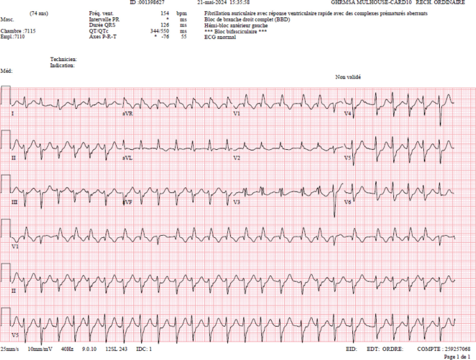 ECG 4 | Springer Nature Link