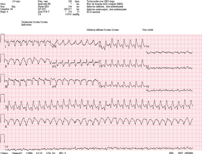 ECG 49 | Springer Nature Link