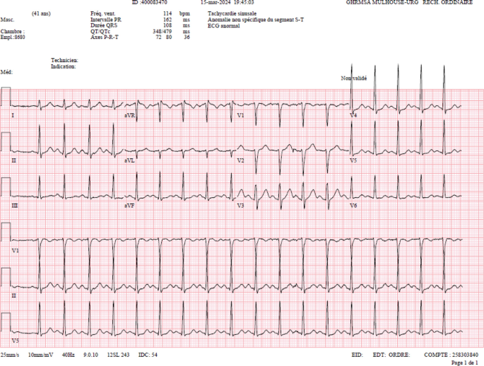 ECG 50 | SpringerLink